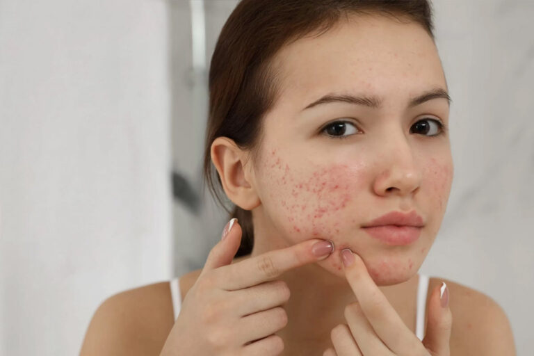 Skin Lounge Clinic | Dr. Simple Aher Clinc